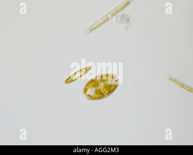 Amphora ovalis (Amphora ovalis), in shining-through light Stock Photo ...