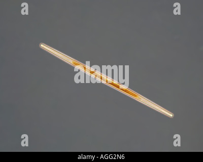 Synedra ulna (Synedra ulna Stock Photo - Alamy