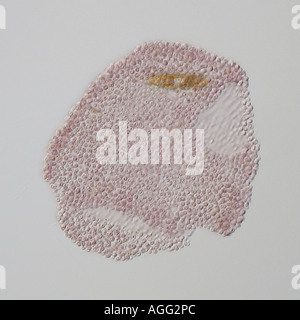 Microcystis flos-aquae (Microcystis flos-aquae), in shining-through ...