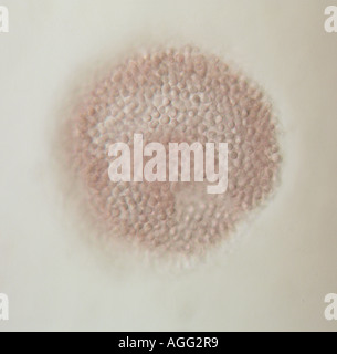 Microcystis flos-aquae (Microcystis flos-aquae), in shining-through ...