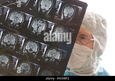 x-rays of cerebral cortex cerebellum human brain MRI Stock Photo - Alamy