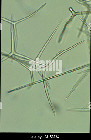 Typical trirradiates calcareous spicules from Sycon ciliatum enlarged x ...