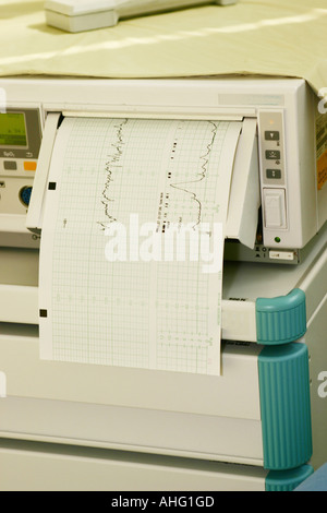 cardiotocograph, CTG, heart sound chart of an unborn child and a ...