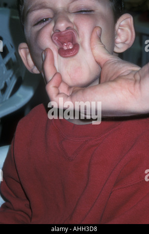 Boy squeezing his face portrait Stock Photo - Alamy