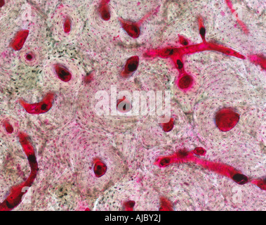 Human compact bone, light micrograph Stock Photo - Alamy