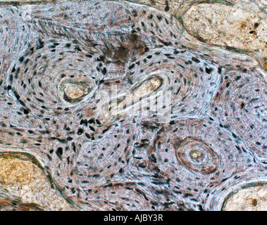 Human compact bone, light micrograph Stock Photo - Alamy