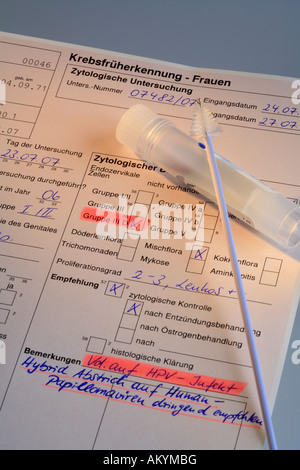 PAP Smear Medical check up test tube with biological sample Stock Photo ...