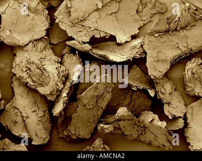 Skin bacteria, SEM Stock Photo - Alamy