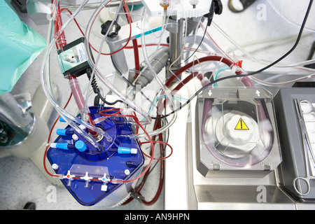 Heart lung machine pumping blood during bypass surgery, Reykjavik ...