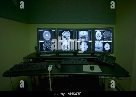 Picture Archiving and Communications System 4 Stock Photo - Alamy