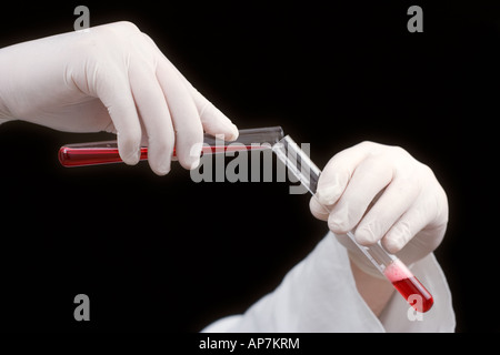 Medical worker examining a blood samples Stock Photo - Alamy