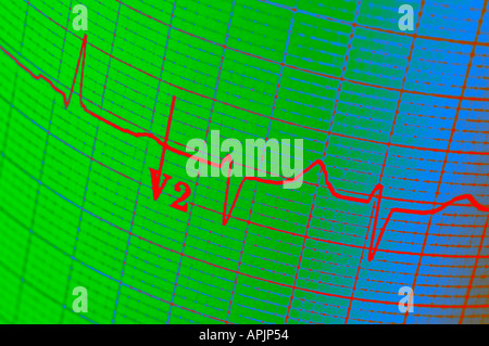 EKG electrocardiogram closeup view concept Stock Photo - Alamy