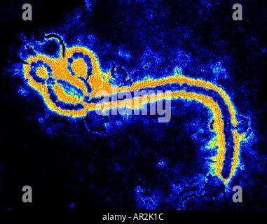 Ebola virus transmission electron micrograph image colorized Original ...