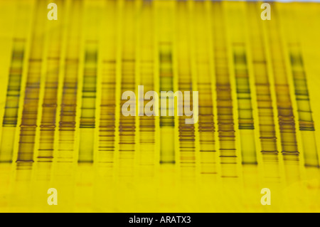 DNA profiles from soil samples show bands representing individual ...