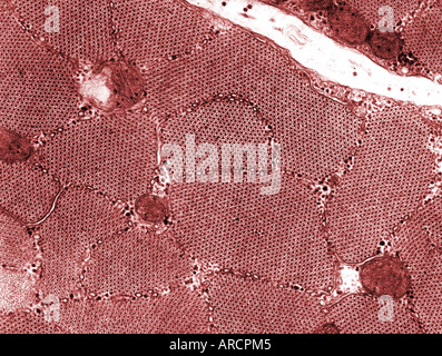 A transmission electron micrograph (TEM) of striated skeletal muscle in longitudinal section ...