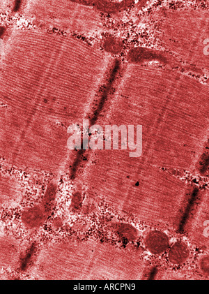 A transmission electron micrograph (TEM) of skeletal muscle in cross section Stock Photo - Alamy