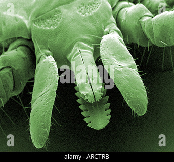 A scanning electron micrograph (SEM) of the deer tick (Ixodes dammini ...