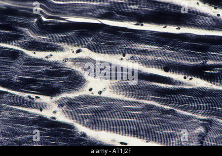 Photomicrograph of cells of striated muscle Stock Photo - Alamy