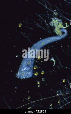 Stentor Ciliata Protozoans Optic microscopy Stock Photo - Alamy