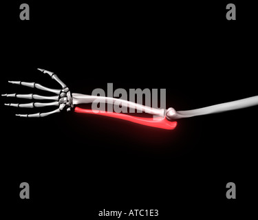 ulna highlighted red on human skeleton Stock Photo - Alamy