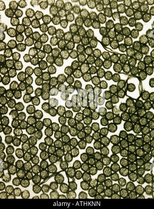 Trachea. Transmission electron micrograph (TEM) of a tangential section ...