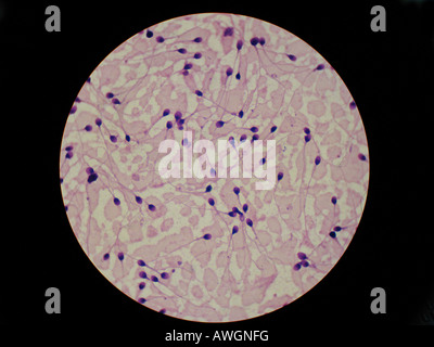 Sperm morphology test Stock Photo - Alamy