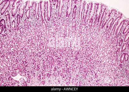 Anatomy of human digestive system with stomach, small intestine Stock ...