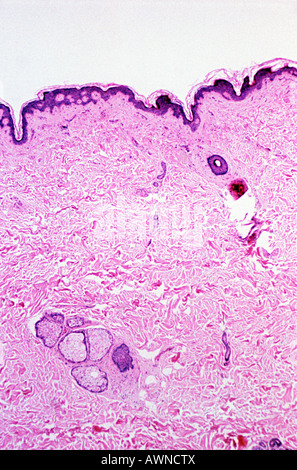 Human skin cells , Skin anatomy Stock Photo: 75039798 - Alamy