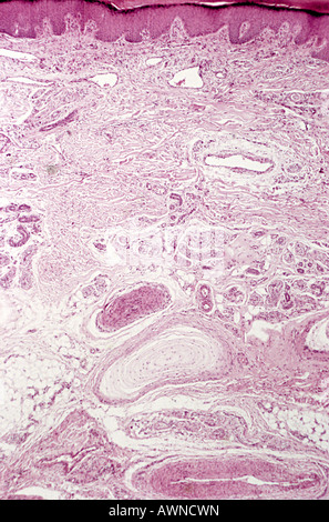 medicine microscope microscopy histology skin scalp hair crosswise ...