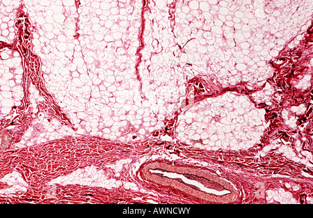 medicine microscope microscopy histology skin scalp hair crosswise ...