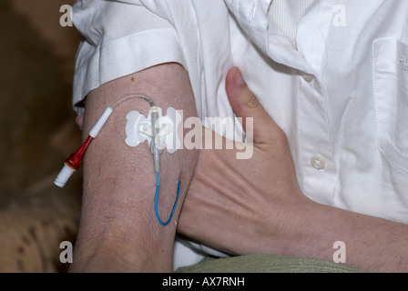 Picc line exposed prior to covering in arm of female cancer patient ...
