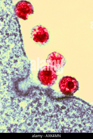 HIV virus budding from cell. Coloured Transmission Electron Micrograph ...