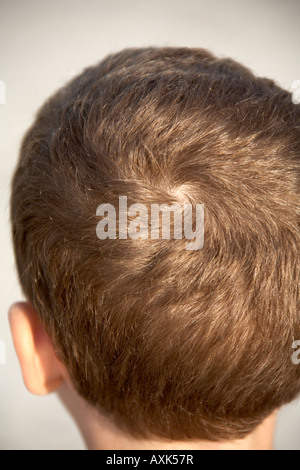 Swirl spiral pattern of hair on the bakc of a young boy child s head ...