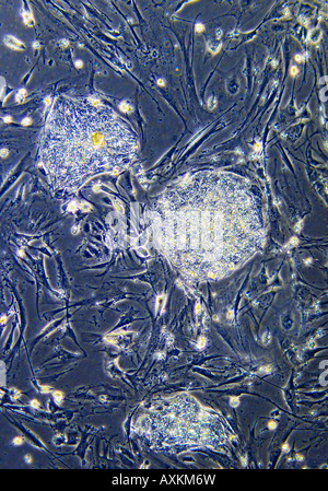 human embryonal stem cell as seen through light microscope Stock Photo ...