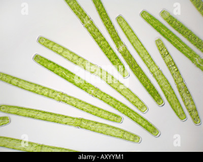 Pleurotaenium trabecula (Pleurotaenium trabecula), in shining-through ...