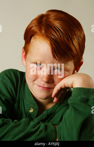 Red cheek in an 8 year old male patient with Fifth disease (slapped ...