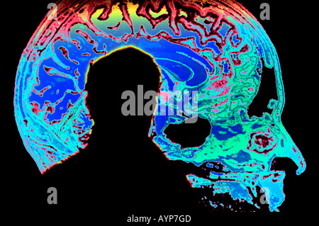 teacher showing human skull display in laboratory Stock Photo - Alamy