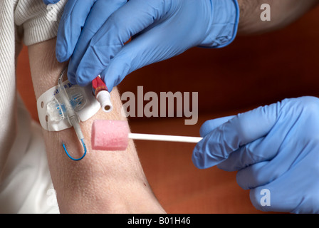 Cleaning a picc line with a swab (peripherally inserted central ...
