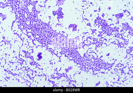 Staphylococcus aureus bacteria, light micrograph. These Gram-positive ...