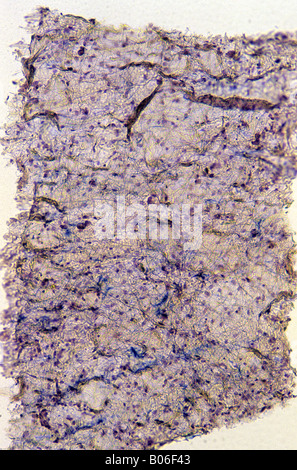 Microscope slide preparation. Close-up of a student preparing an onion ...