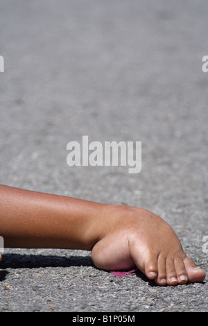 Deformed leg by roadside closeup Stock Photo - Alamy