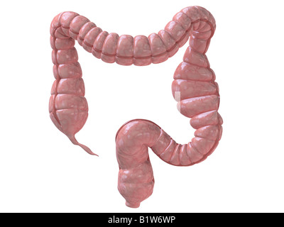 colon - blockage Stock Photo: 18989046 - Alamy
