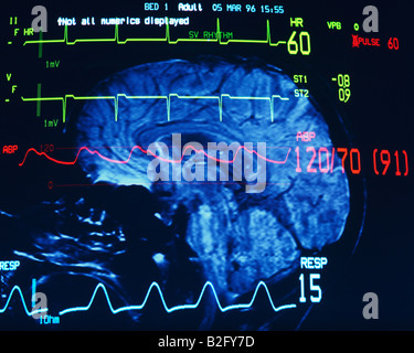 Horizontal section of a human brain - MRI scan Stock Photo - Alamy