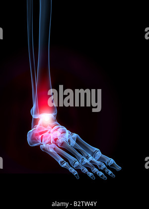 3d illustration of Pain in leg Stock Photo - Alamy