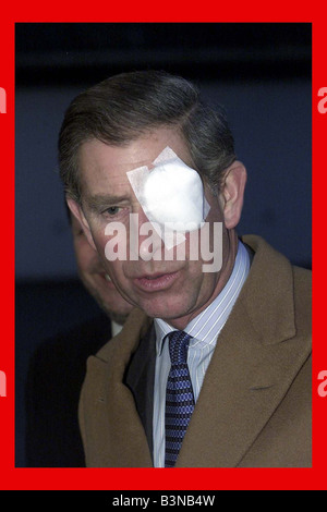 Prince Charles Eye Patch Stock Photo - Alamy