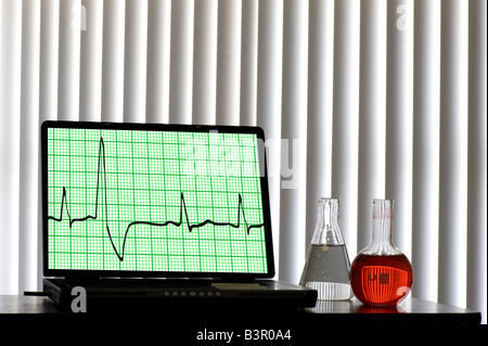 EKG Electrocardiogram displayed on laptop computer Stock Photo - Alamy