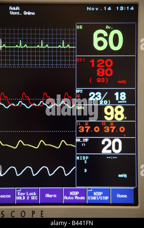Vital signs data medical monitor for measurement of important vital ...