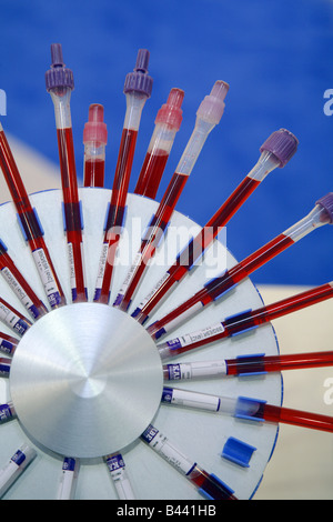 The erythrocyte sedimentation rate (ESR) test Stock Photo - Alamy