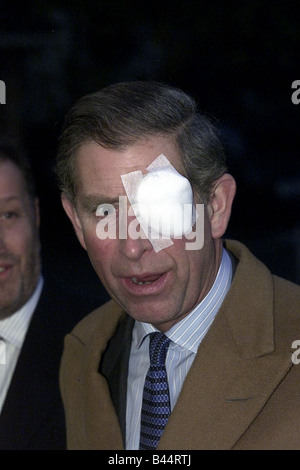 Prince Charles Eye Patch Stock Photo - Alamy