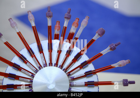 The erythrocyte sedimentation rate (ESR) test Stock Photo - Alamy